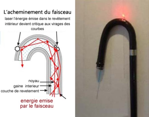 Laser Holmium Themis 30W - In Advance Medical Technology